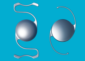 PMMA (1) - AJL Ophthalmic